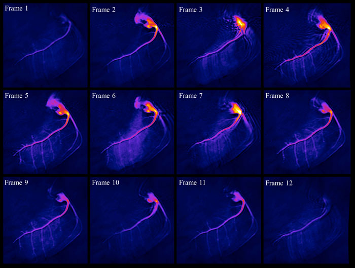 Novel MR contrast agent for angiography and perfusion: Hyperpolarized ...